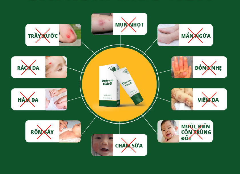 Sản phẩm liên quan